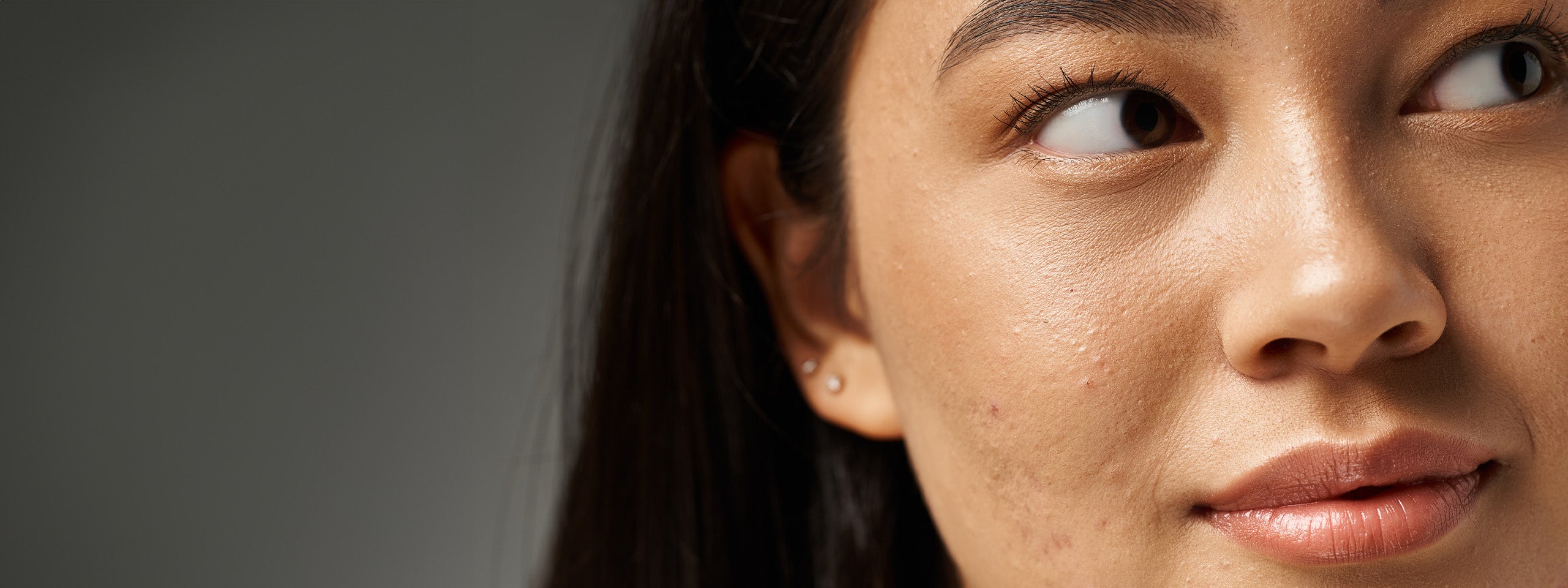 Spot/Acne Prone Skin – Cantabria Labs